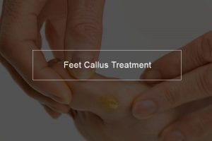 Do calluses go away on their own? - Stopyourskinproblem.com